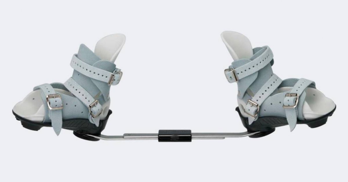 metodo Ponseti - Ortopedia Zambelli Bergamo