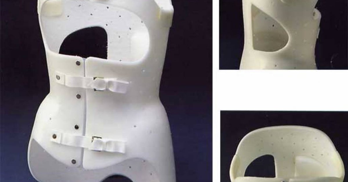 Corsetti per scoliosi : Milwakee, Cheneau, Boston, Lionese, Lapadula ...